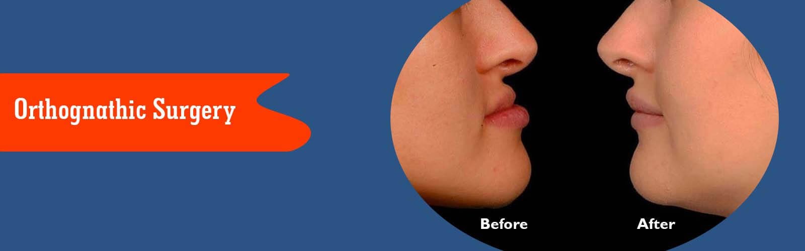 Best dentist in hyderabad – Apollo DRDO Dental